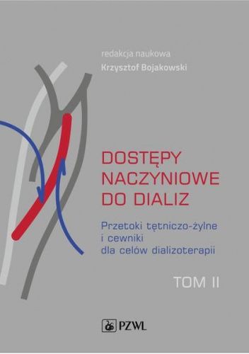 Dostępy naczyniowe do dializ. Tom 2 - Krzysztof Bojakowski | Książka w ...