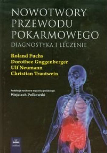 Nowotwory przewodu pokarmowego. Diagnostyka i leczenie - Roland Fuchs, Dorothee Guggenberger ...