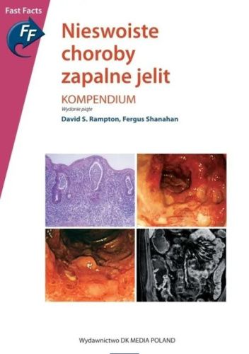 Nieswoiste choroby zapalne jelit. Kompendium - David S. Rampton, Fergus ...